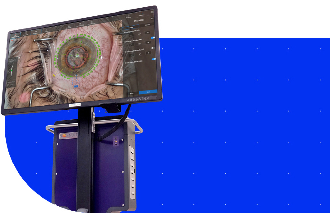 Alcon Ngenuity | Eyetube